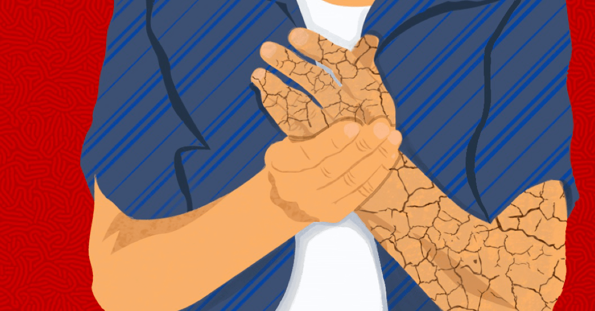 How Chronic Kidney Disease Affects the Skin