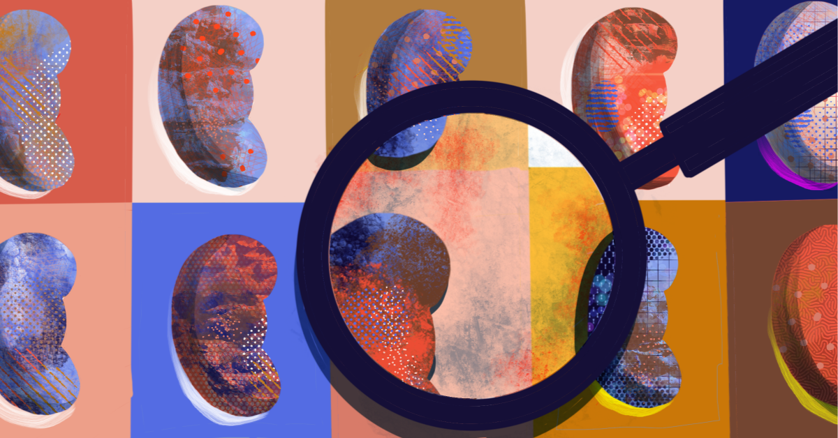 Paired Kidney Exchange | Chronic-Kidney-Disease.net