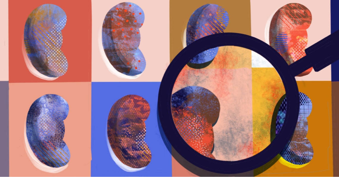 My Experience Getting Diagnosed With Chronic Kidney Disease Ckd